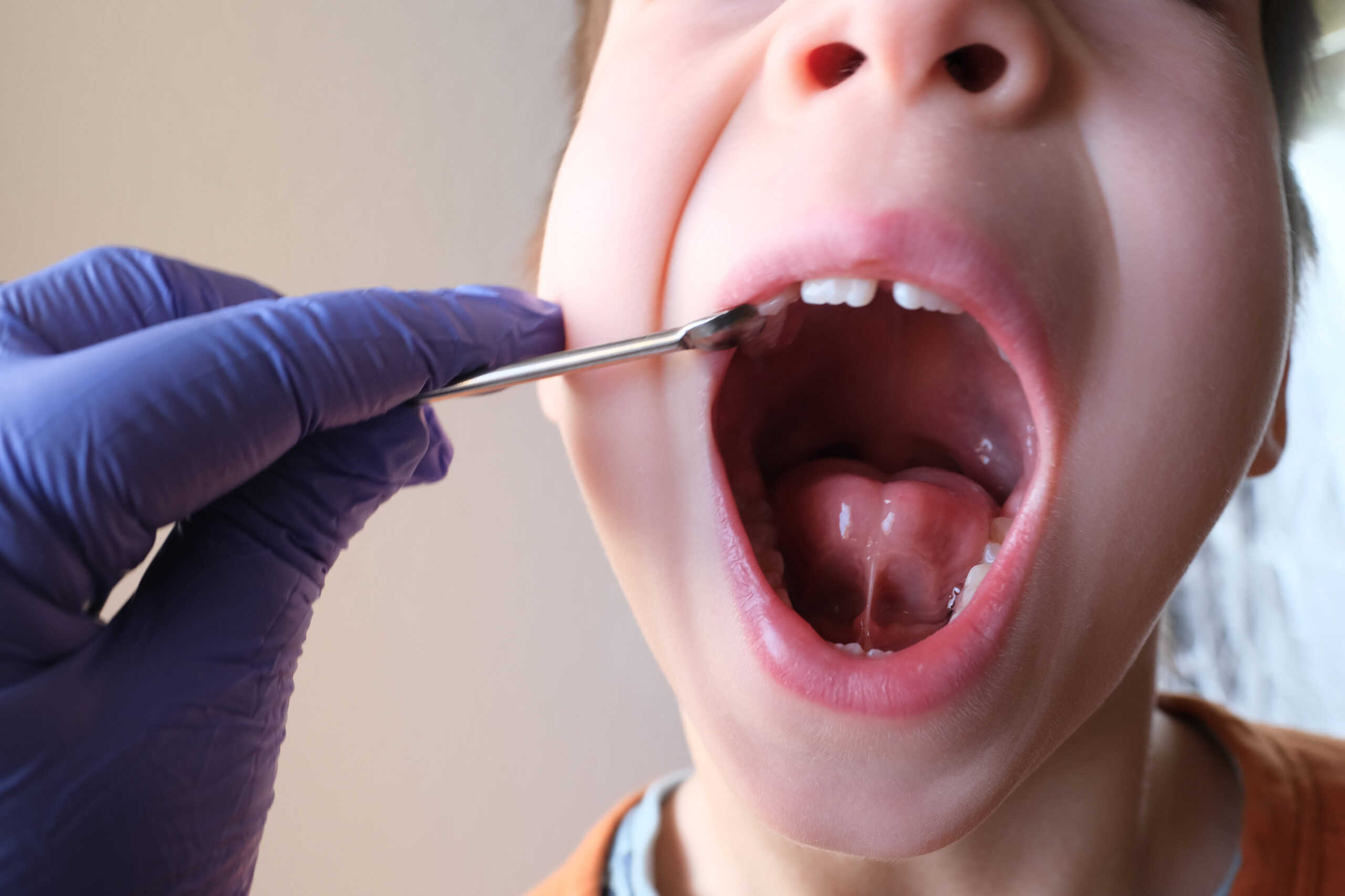 Chirurgie | Apolline Dental Care | Cabinet Dentaire Spécialisé
